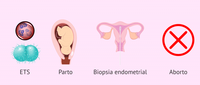 Salpingitis: definición, causas, síntomas y tratamiento