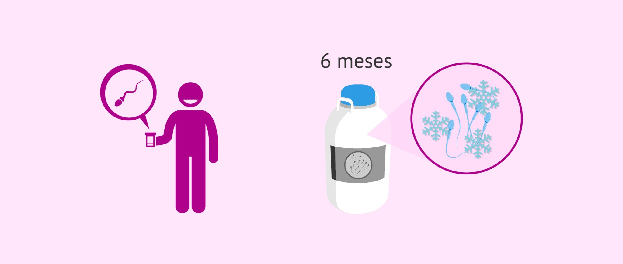 ¿En qué consiste la congelación de espermatozoides?