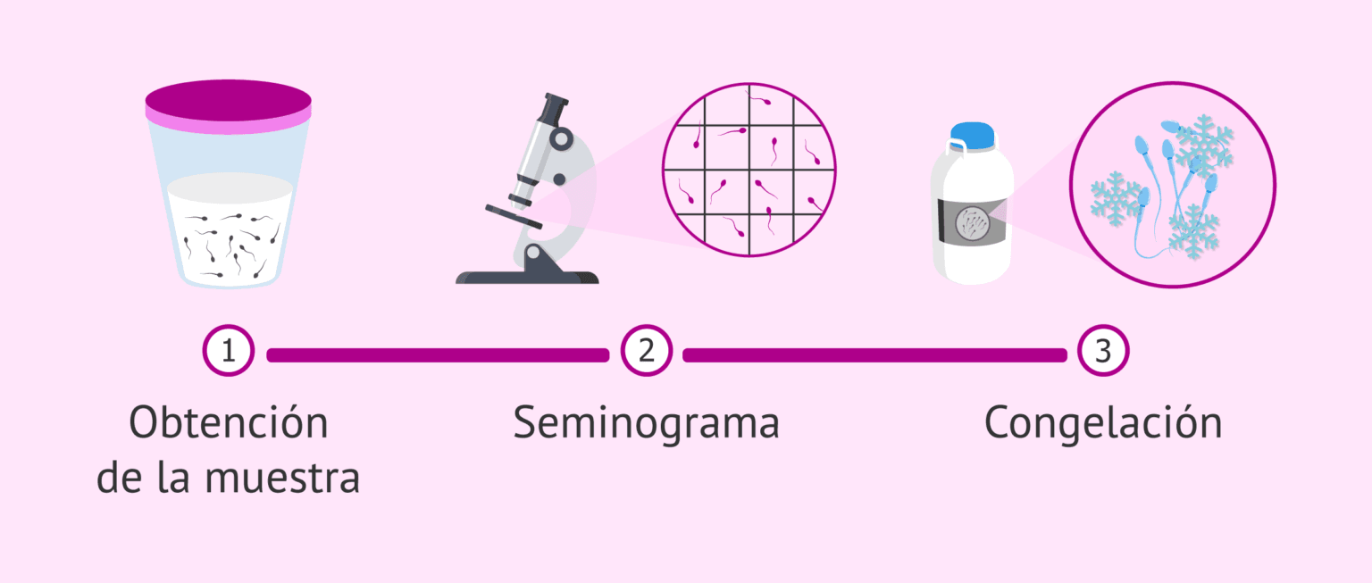 ¿En qué consiste la congelación de espermatozoides?