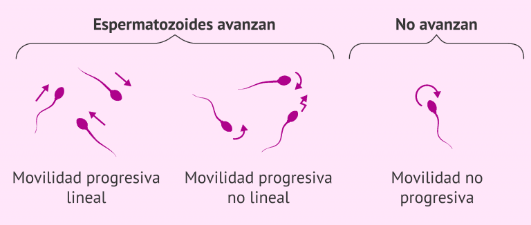 ¿Qué es la astenospermia y cómo se puede conseguir el embarazo?