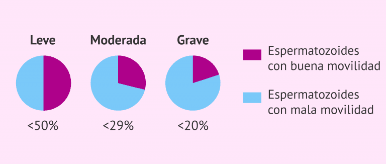 Grados de la astenozoospermia
