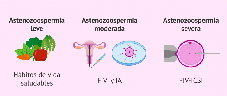 ¿Qué es la astenospermia y cómo se puede conseguir el embarazo?